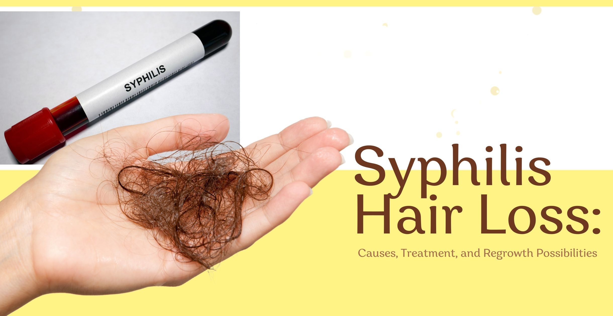 Syphilis Hair Loss: Causes, Treatment, and Regrowth Possibilities ...