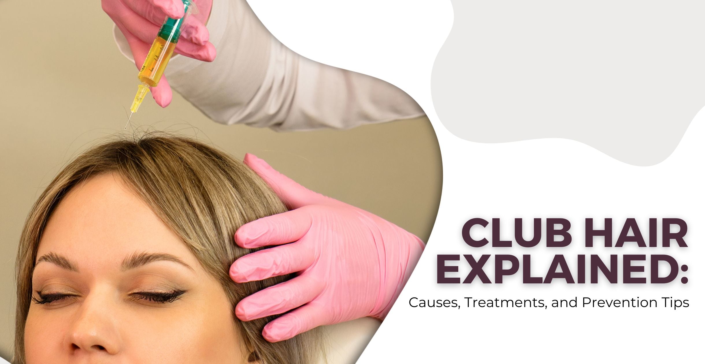 Club Hair Explained: Causes, Treatments, and Prevention | Clinikally