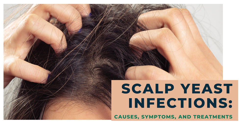 Scalp Yeast Infections: Causes, Symptoms, and Treatments | Clinikally