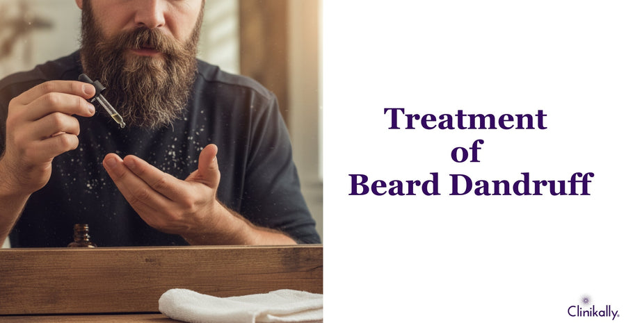 Beard Dandruff Treatment in Winter: Dermatologist Guide