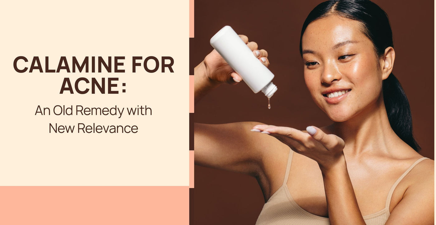 Calamine for Acne: An Old Remedy with New Relevance | Clinikally