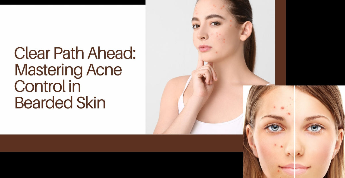 Clear Path Ahead: Mastering Acne Control in Bearded Skin | Clinikally