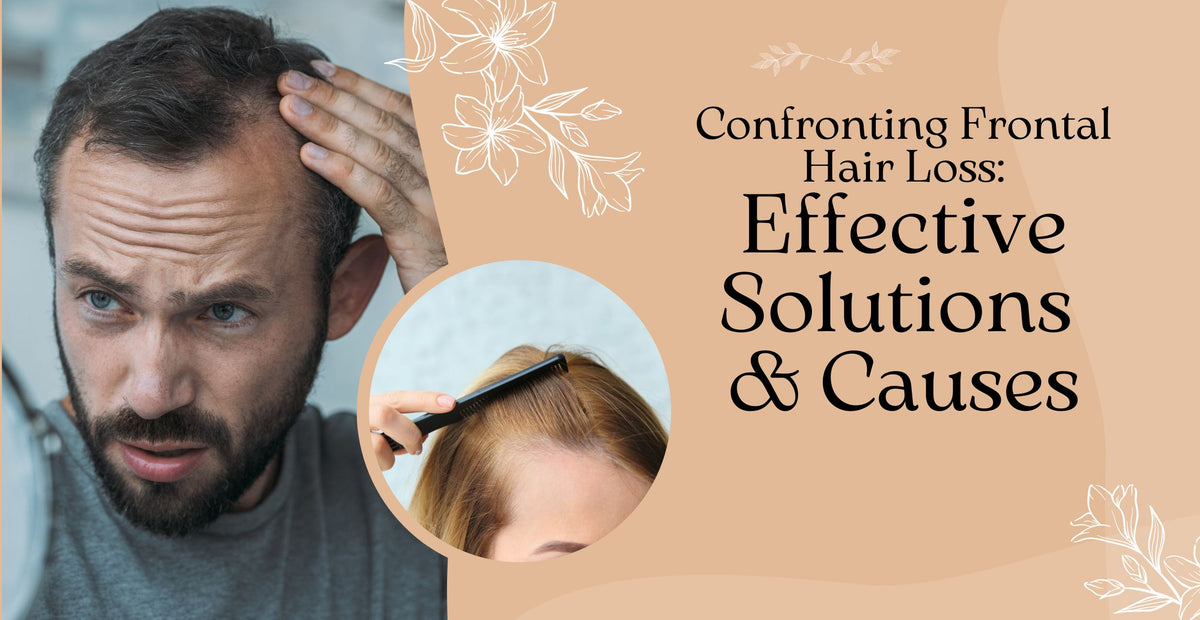 Confronting Frontal Hair Loss: Effective Solutions and Causes | Clinikally