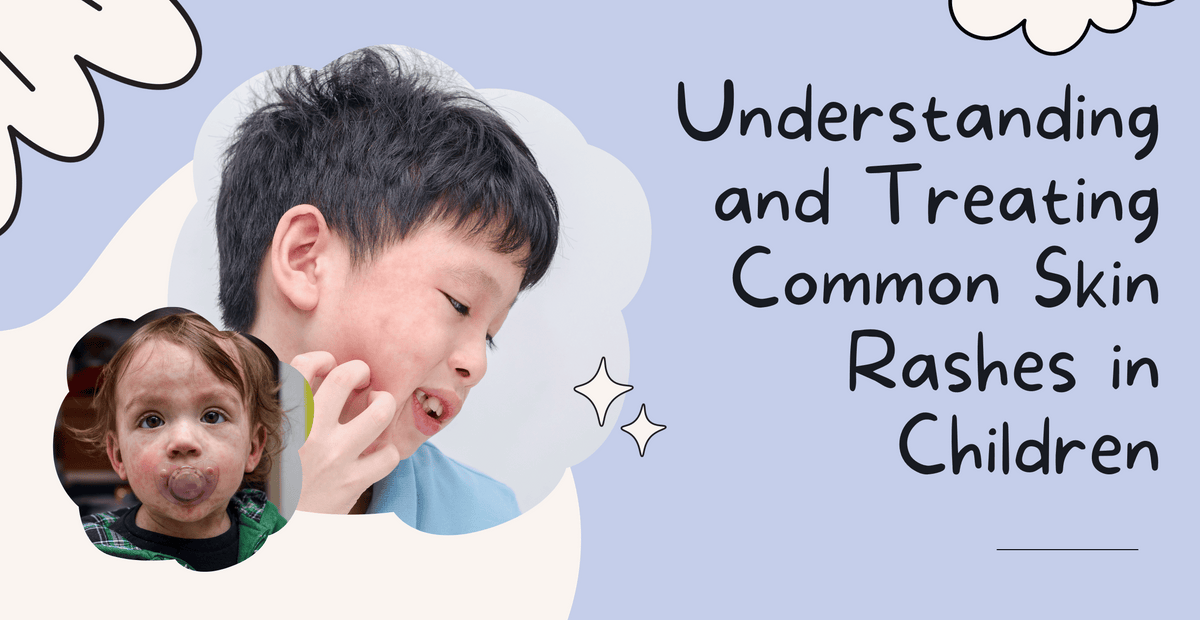 Understanding and Treating Common Skin Rashes in Children | Clinikally