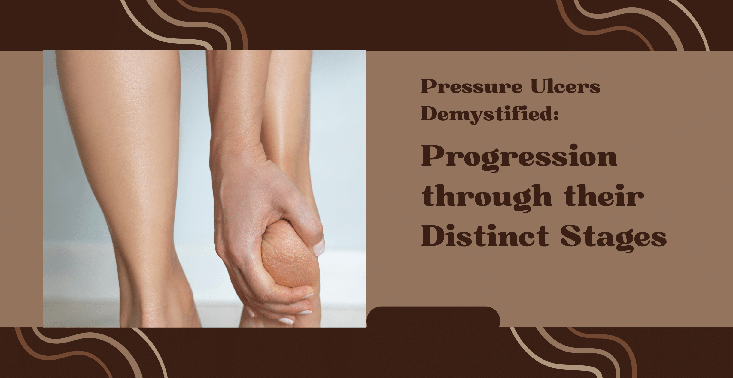 Pressure Ulcer Staging Quiz