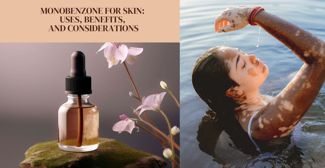 Monobenzone for Skin: Uses, Benefits, and Considerations | Clinikally