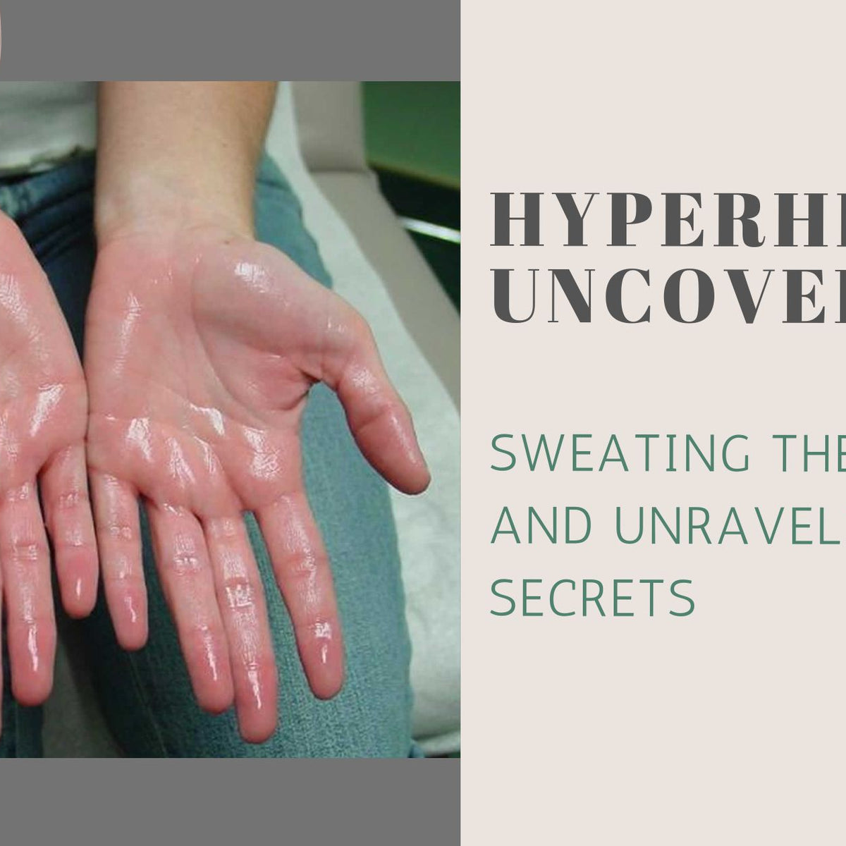 hyperhidrosis hands