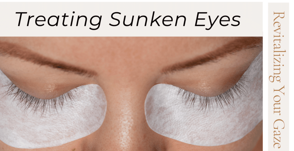 5 Rapid Remedies for Treating Sunken Eyes | Clinikally|