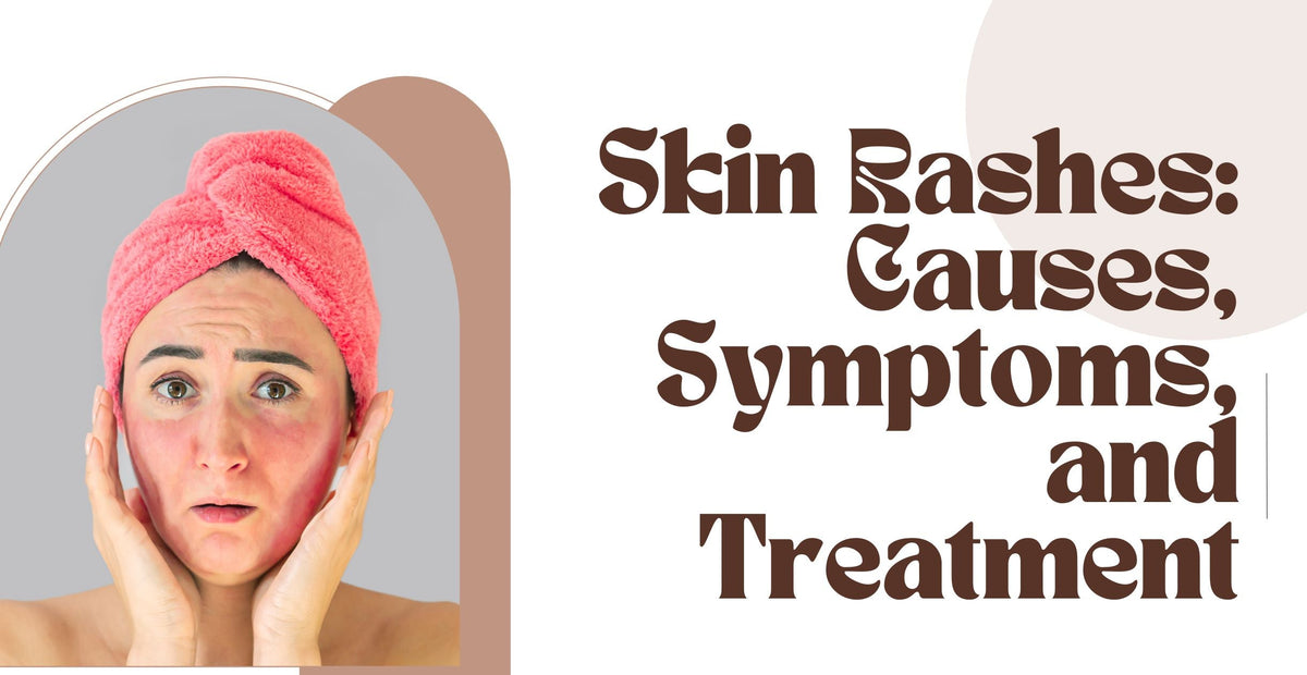 Skin Rashes: Causes, Symptoms, and Treatment | Clinikally