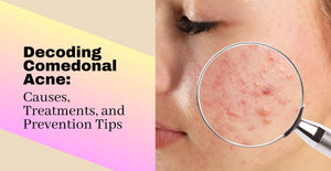 Comedonal Acne: Causes, Treatments, and Prevention Tips | Clinikally