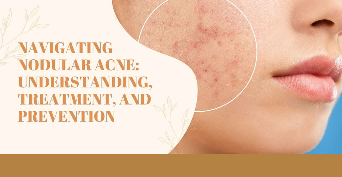 Navigating Nodular Acne: Understanding, Treatment, and Prevention ...