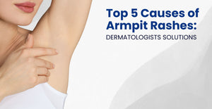 Top 5 Causes of Armpit Rashes: Dermatologists Solutions | Clinikally