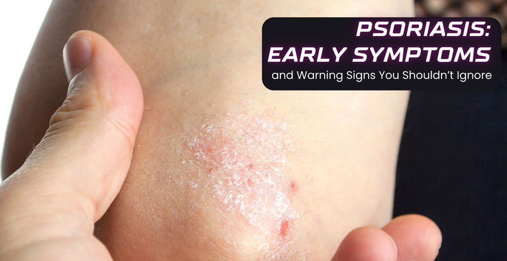 Psoriasis: Early Symptoms and Warning Signs | Clinikally