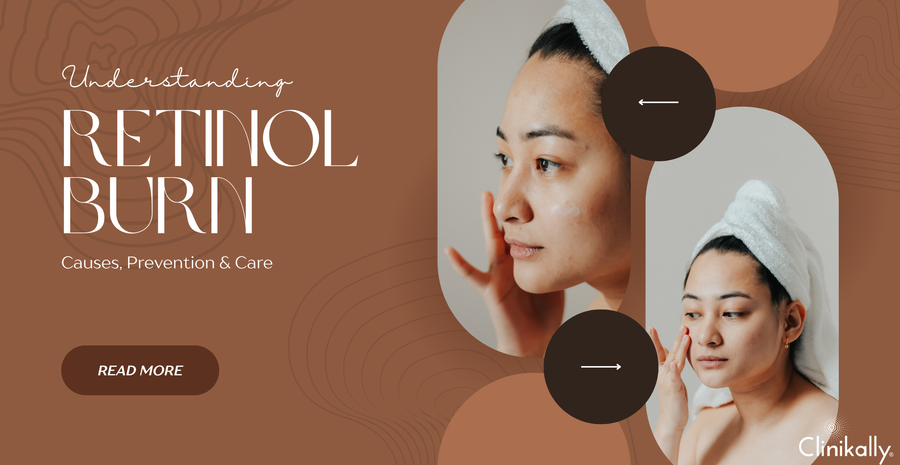 Understanding Retinol Burn: Causes, Prevention, and Care | Clinikally