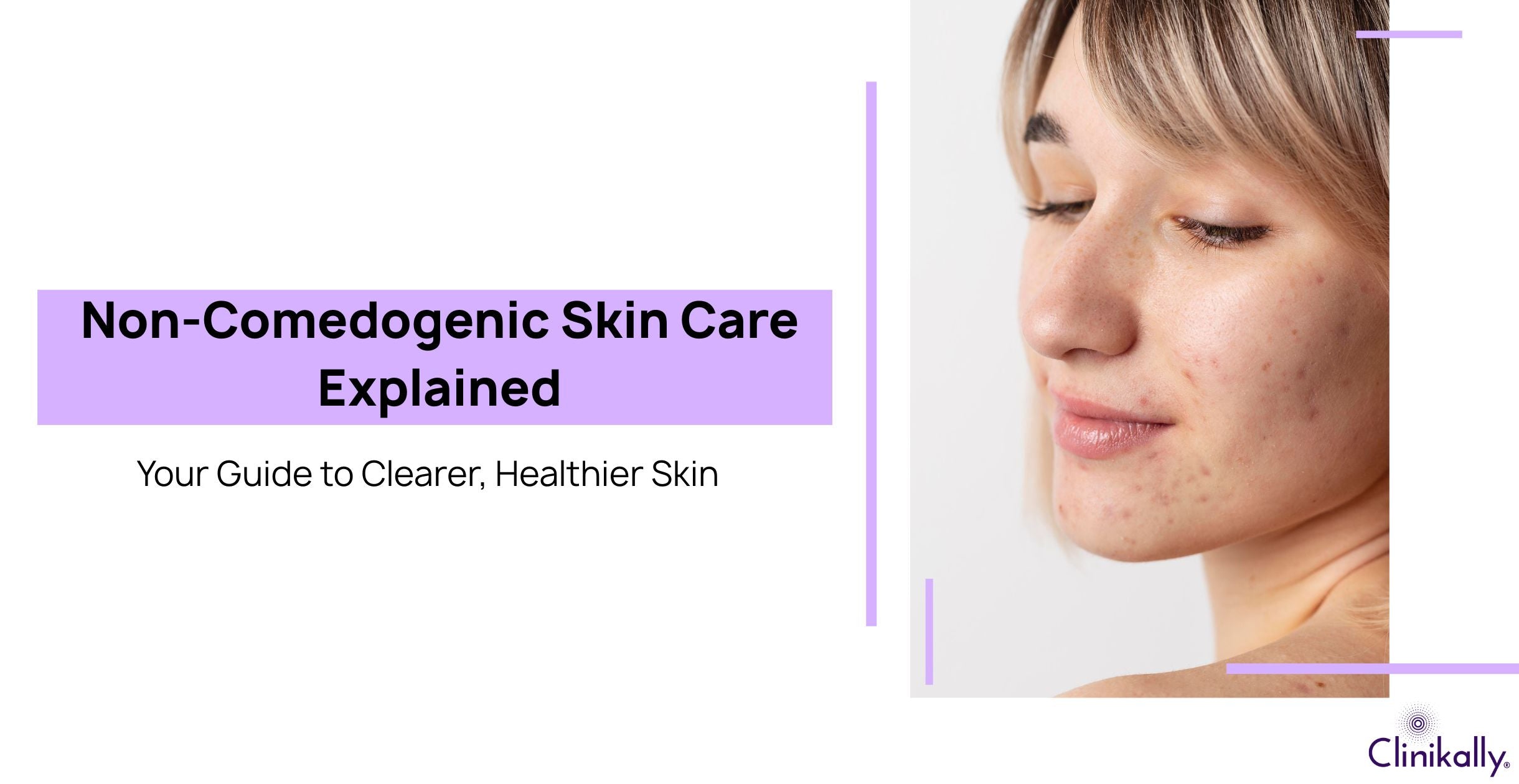 Best Non-Comedogenic Skin Care Guide for Clear & Healthy Skin