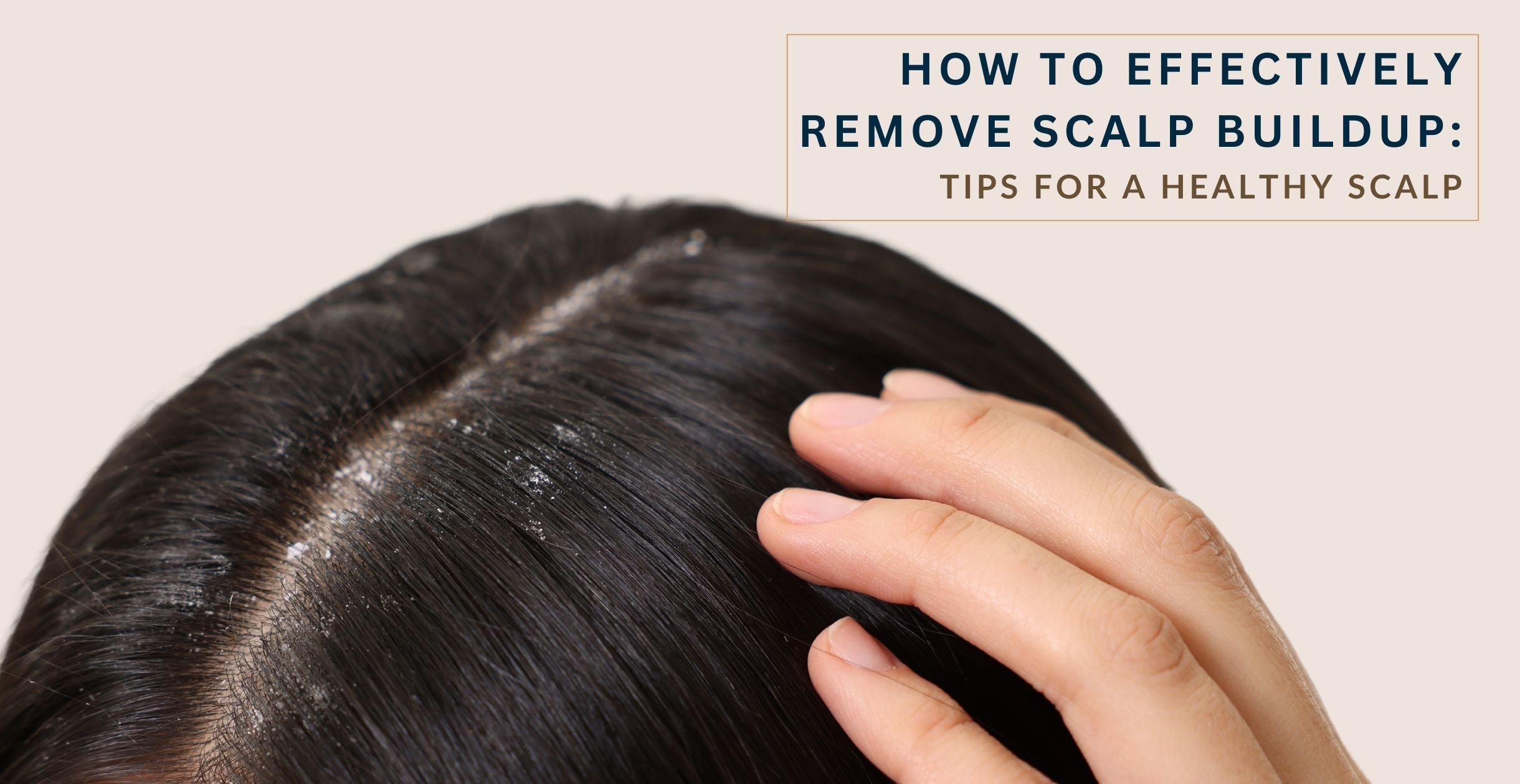 How to Effectively Remove Scalp Buildup: For a Healthy Scalp | Clinikally