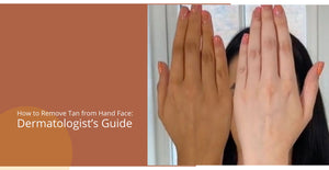 How to Remove Tan from Hand & Face | Clinikally