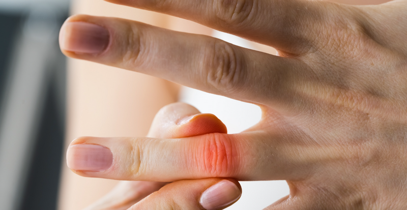 How to Treat Dark Knuckles Effectively | Clinikally