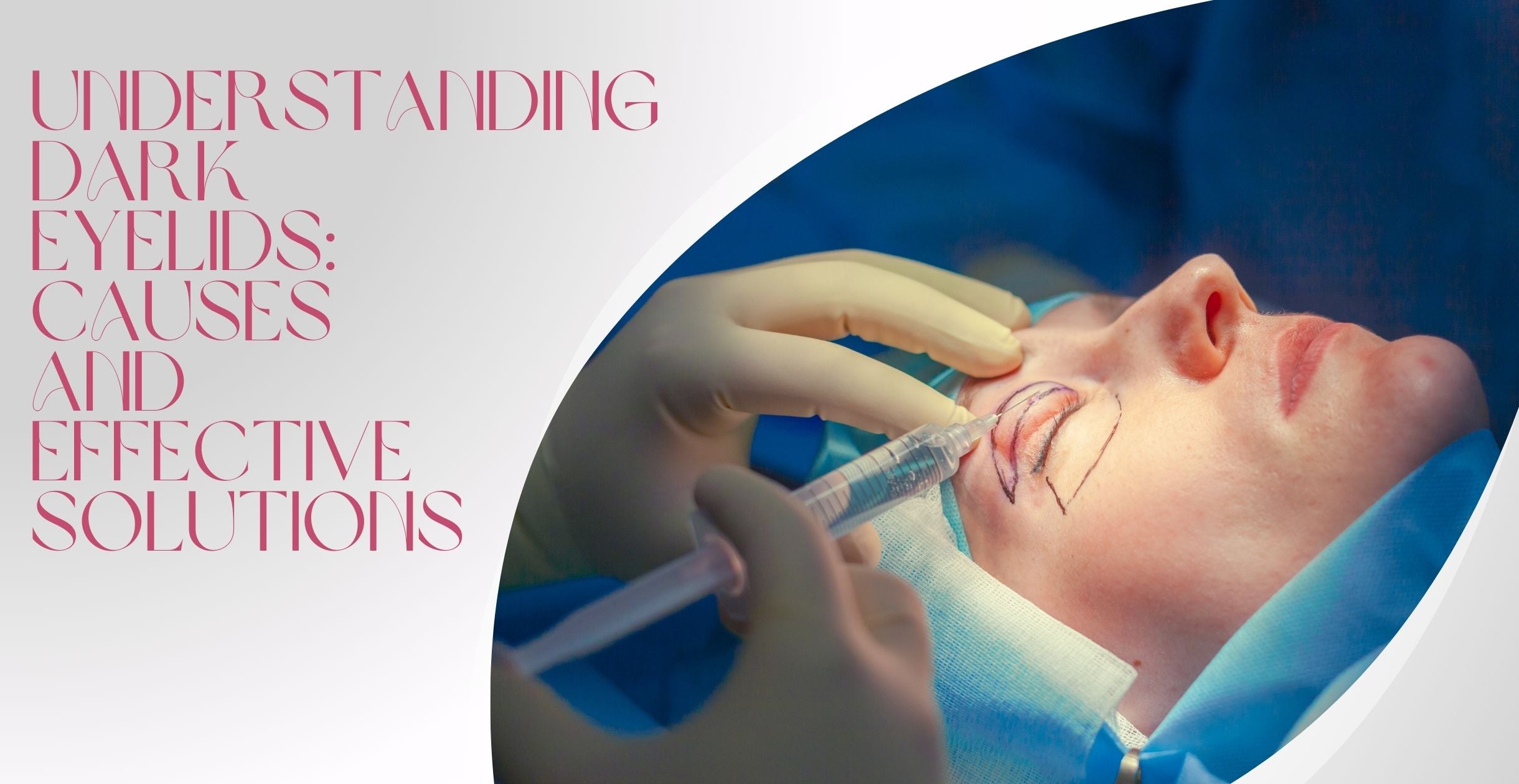 Understanding Dark Eyelids: Causes and Effective Solutions | Clinikally