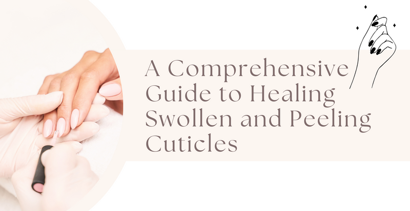 A Comprehensive Guide to Healing Swollen and Peeling Cuticles | Clinikally