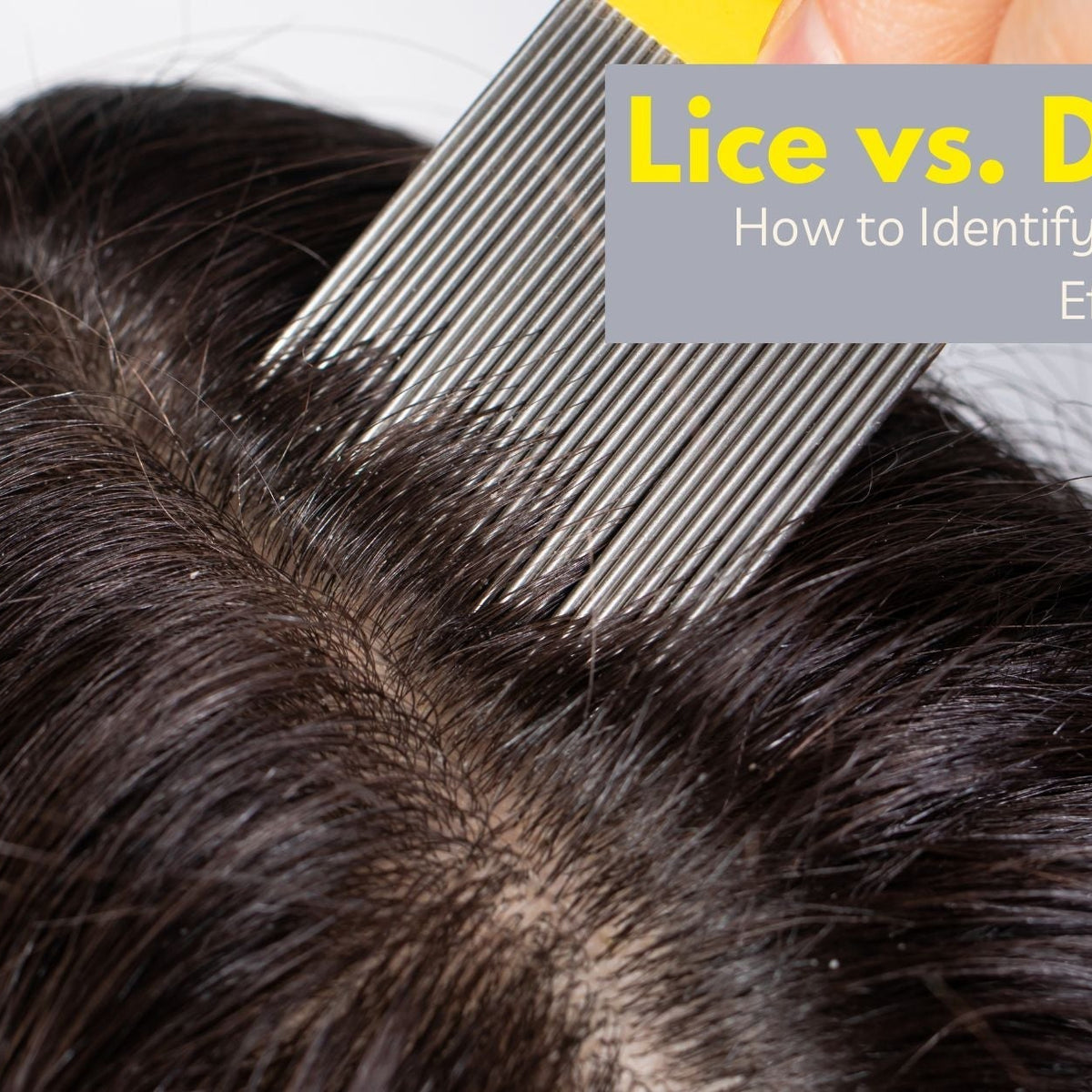 difference between lice eggs and nits