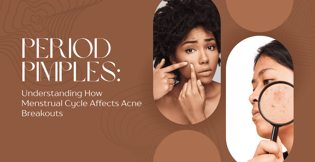 Period Acne: Symptoms, Causes and Treatment | Clinikally