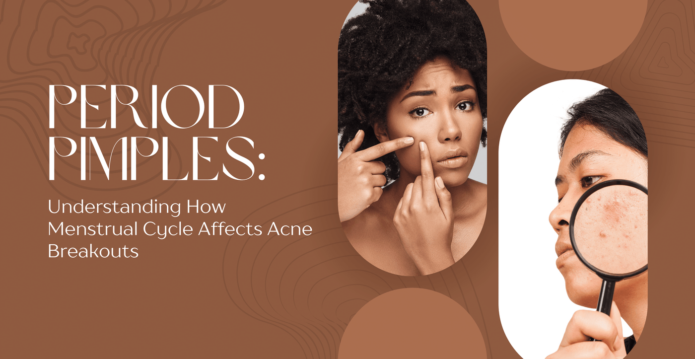 Period Acne: Symptoms, Causes and Treatment | Clinikally