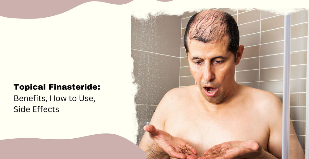Topical Finasteride: Benefits, How to Use, Side Effects