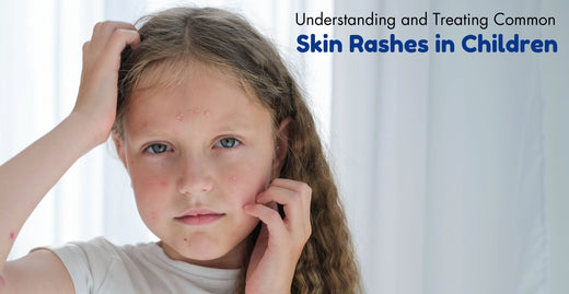 Little Red Flags: Understanding and Managing Kids Skin Issues | Clinikally