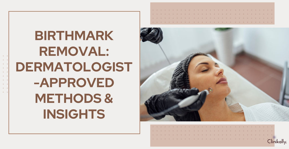 Birthmark Removal: Dermatologist-Approved Methods | Clinikally