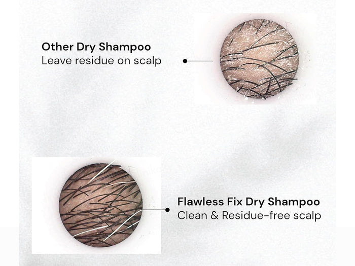 Buy Renewcell Flawless Fix Dry Shampoo Online at Best Price | Clinikally