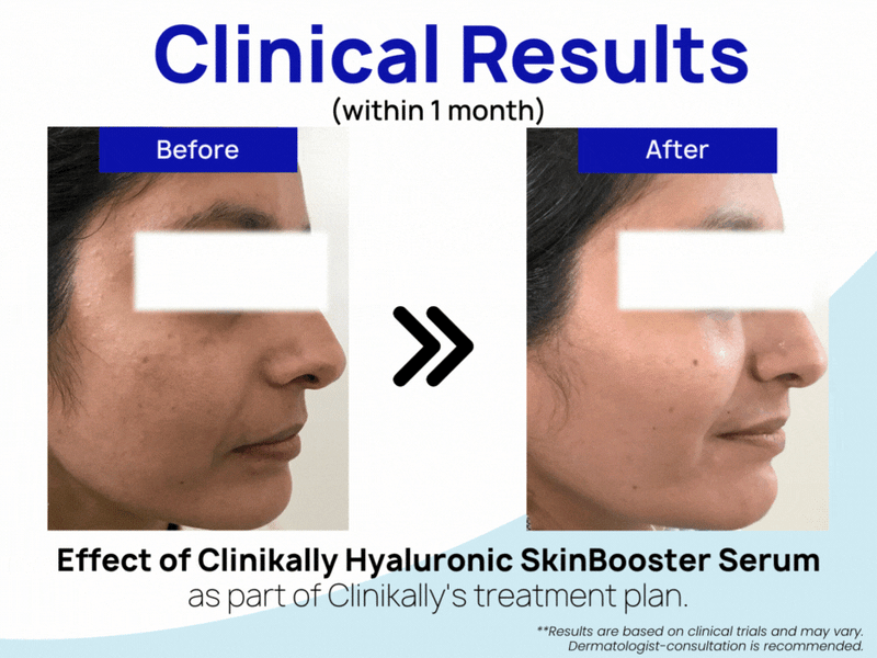 Buy Best Products for Sensitive Skin & Repair Damage Now